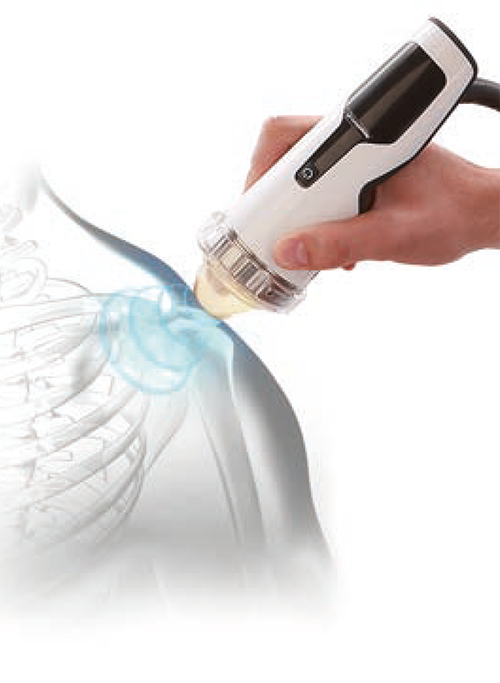 Shockwave Therapy - Gulfcoast Healthcare Group - Cape Coral, FL